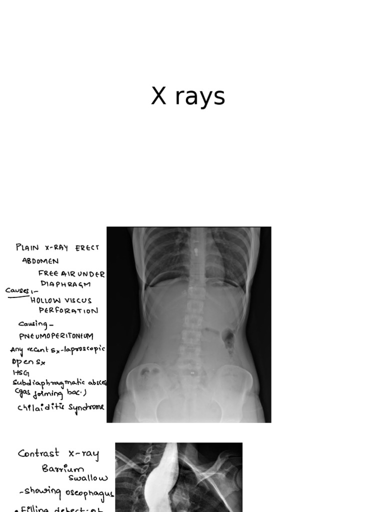 Xrays Ug Exam | PDF