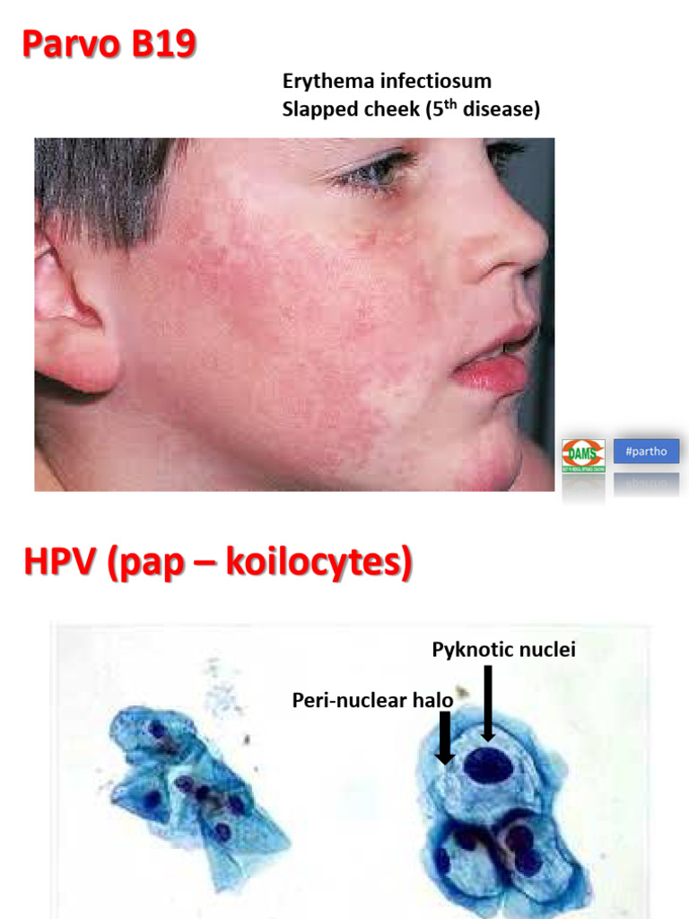 0 Imp Virology | PDF | Virus | Hepatitis B
