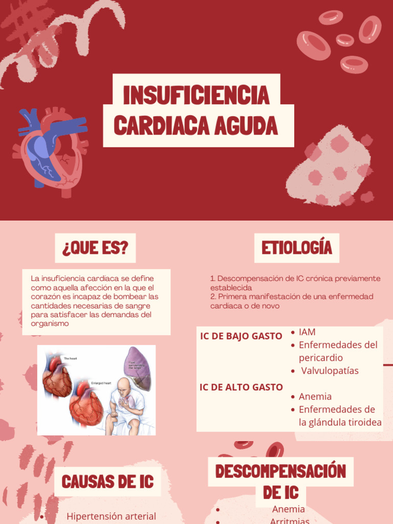 Insuficiencia Cardíaca Aguda: Causas y Tratamiento | PDF ...
