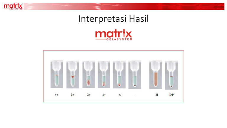 Interpretasi Hasil Matrix Gel Card | PDF