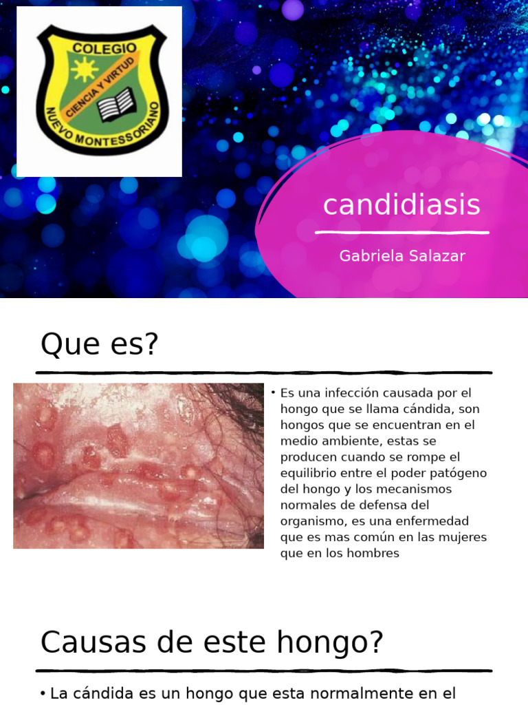 Candidiasis: Causas, Síntomas y Prevención | PDF