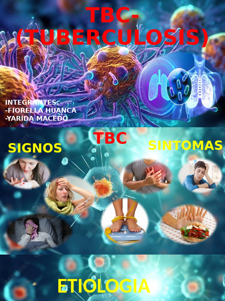 Tbc (Tuberculosis) | PDF