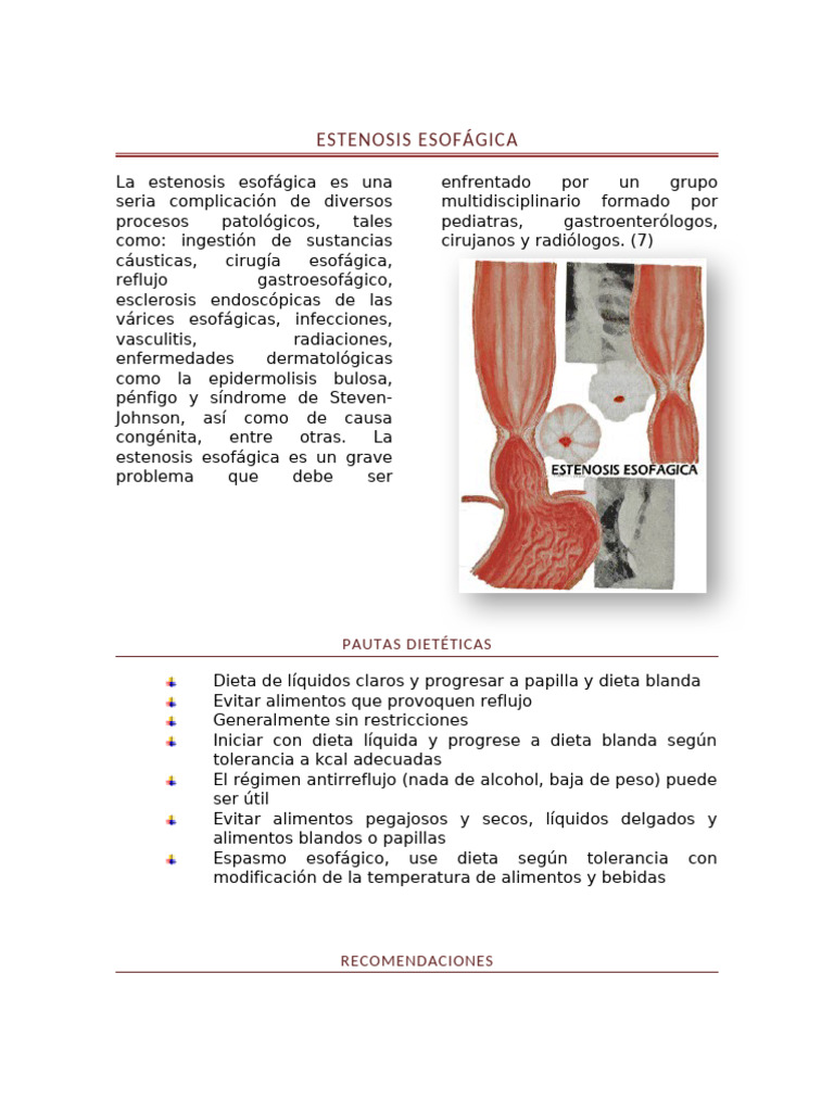 Estenosis esofágica | PDF | Alimentos | Dieta