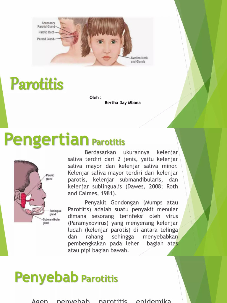 Parotitis PDF | PDF