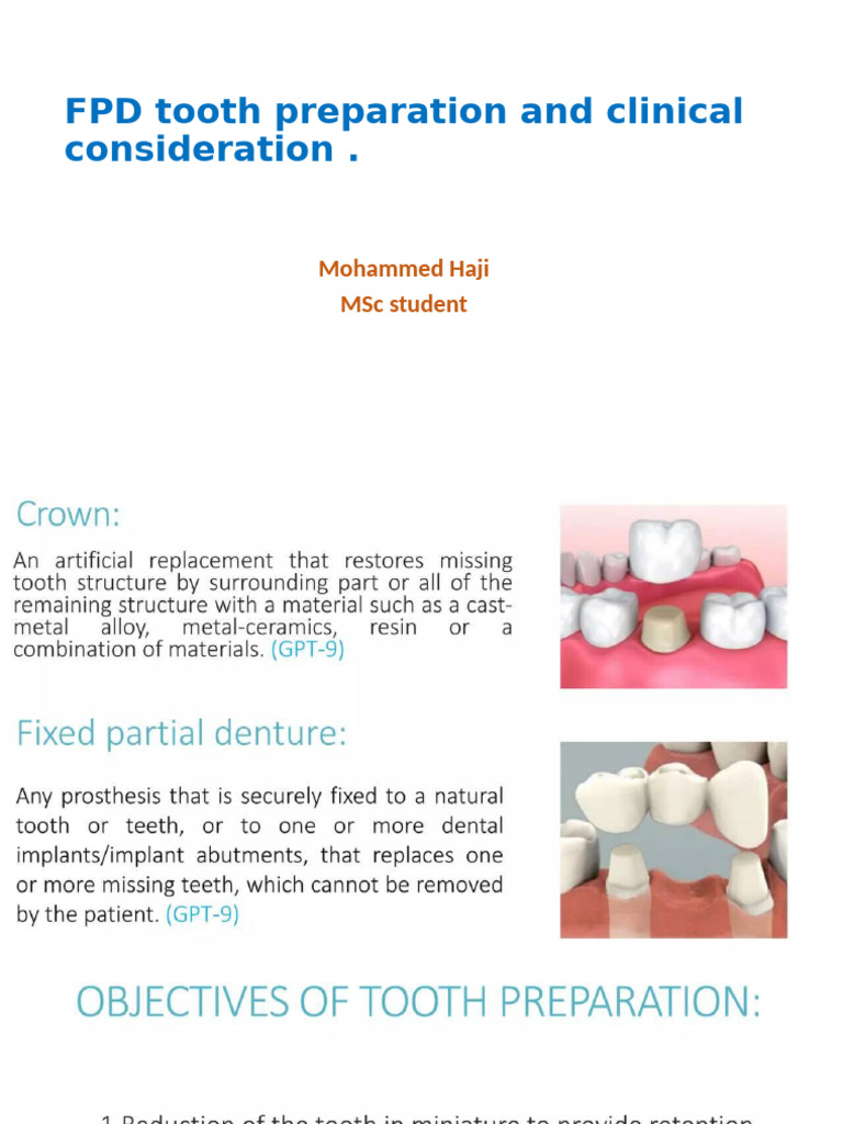 FPD Tooth Preparation | PDF