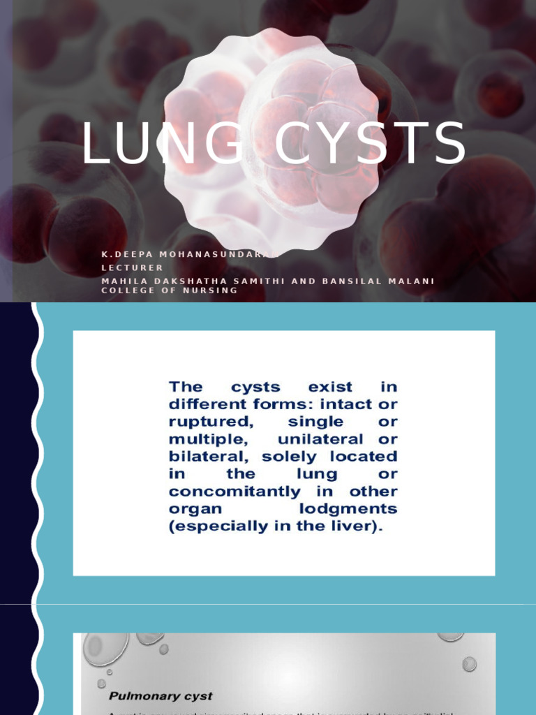 Lung Cysts | PDF