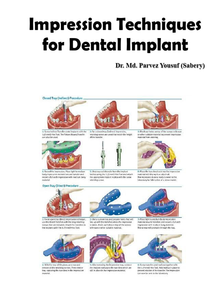 Impression Techniques For Dental Implant | PDF | Dental Implant | Dentistry Branches