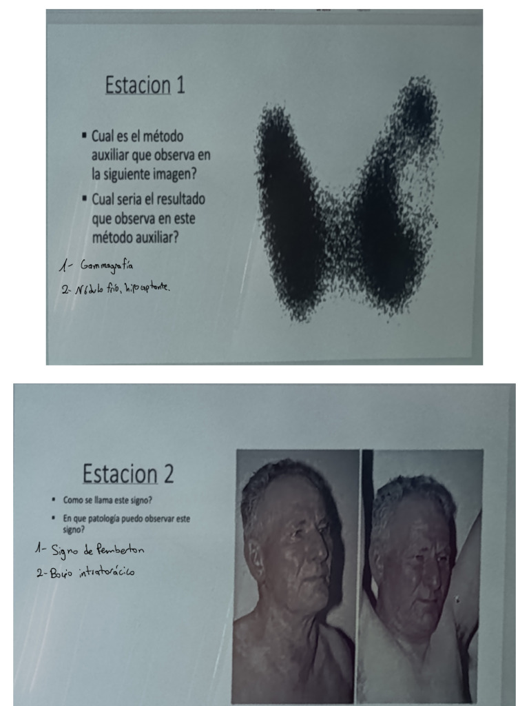 ECOE Semio y Clinica Qx | PDF | Medicina CLINICA | Especialidades Medicas