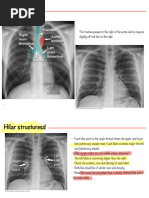 Chest X-Ray Template | PDF | Lung | Thorax