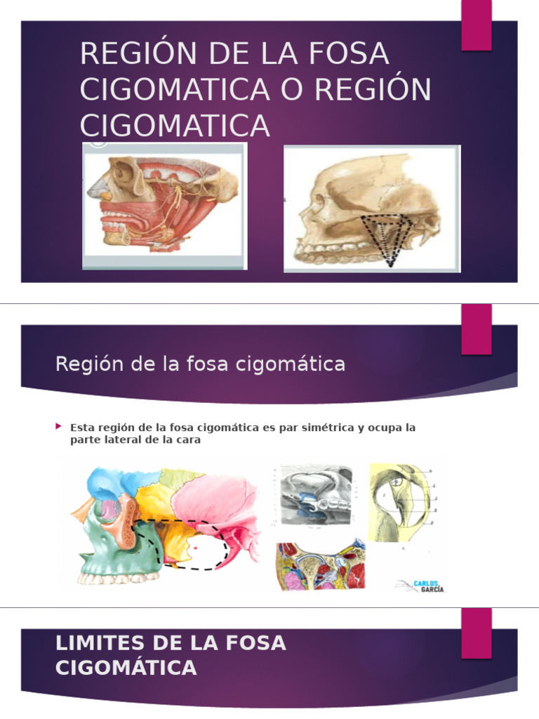 región cigomática | PDF