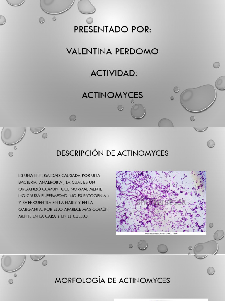 Actinomyces Valentina Perdomo | PDF