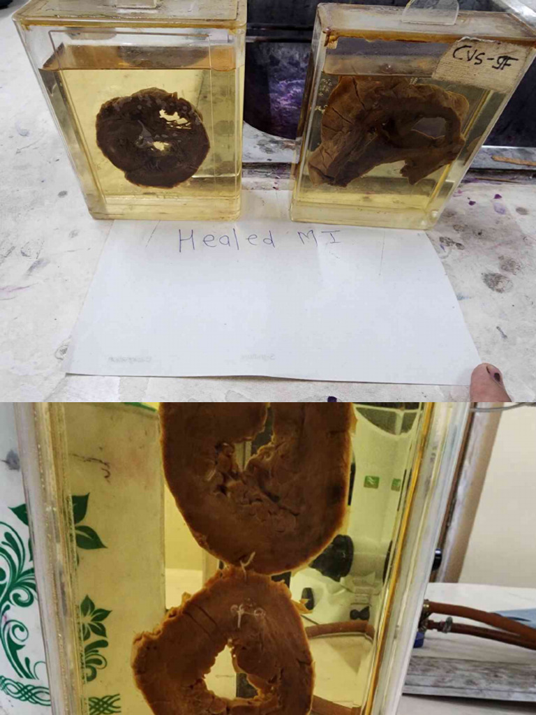 Patho F1 Specimen | PDF