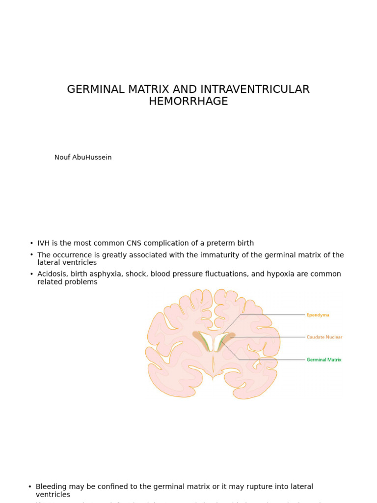 Germinal Matrix and Intraventricular Hemorrhage | PDF | Causes Of Death ...