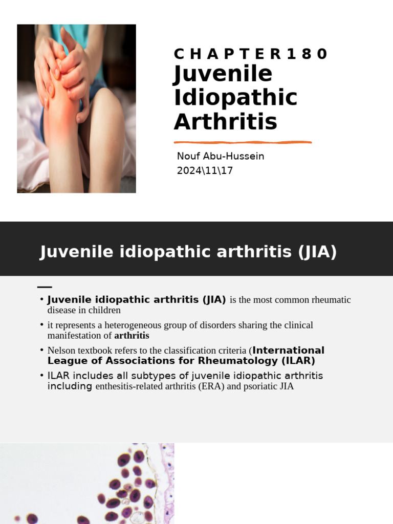 Juvenile Idiopathic Arthritis: Nouf Abu-Hussein 17 / 11 / 2024 | PDF