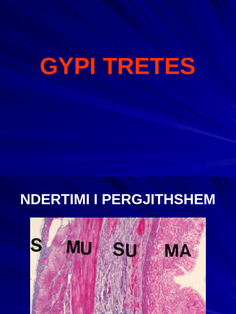 09. Gypi tretes | PDF