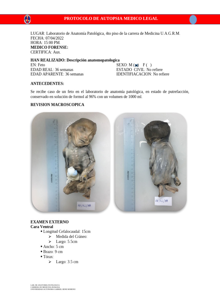 Descripcion de Organo (Feto) | PDF | Anatomía | Tejido conectivo