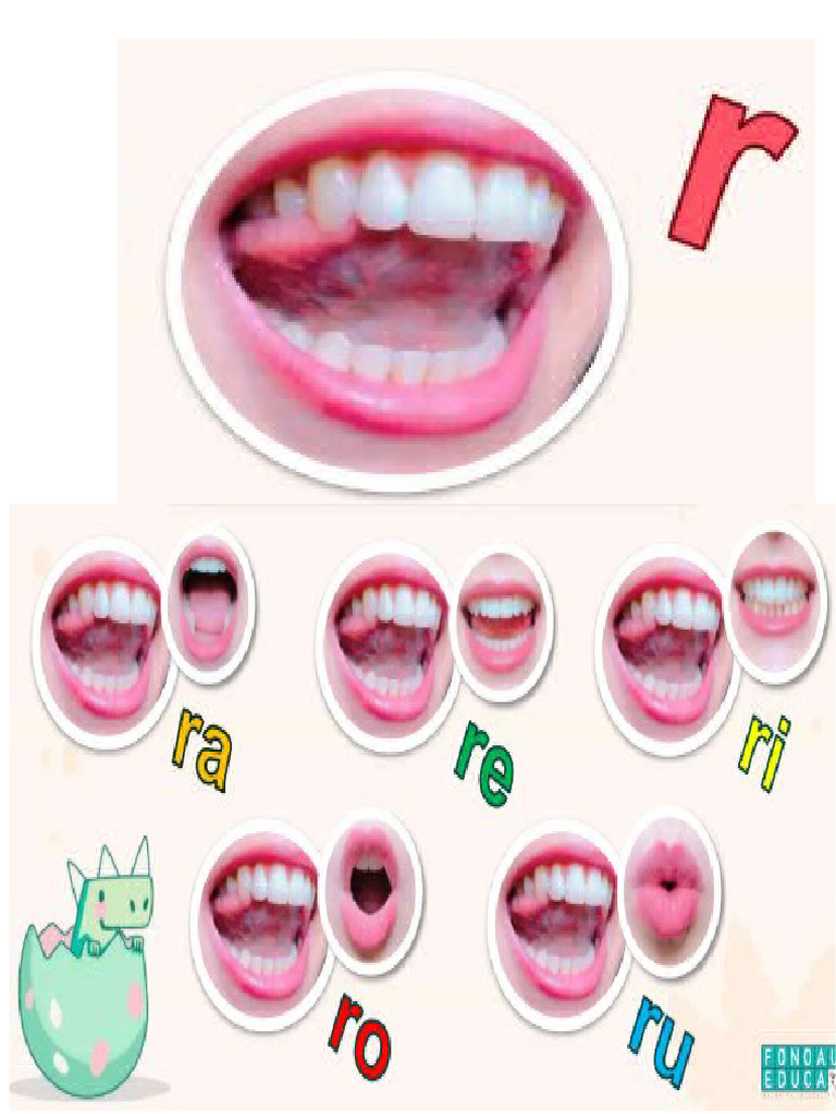 R Posicion de Lengua | PDF