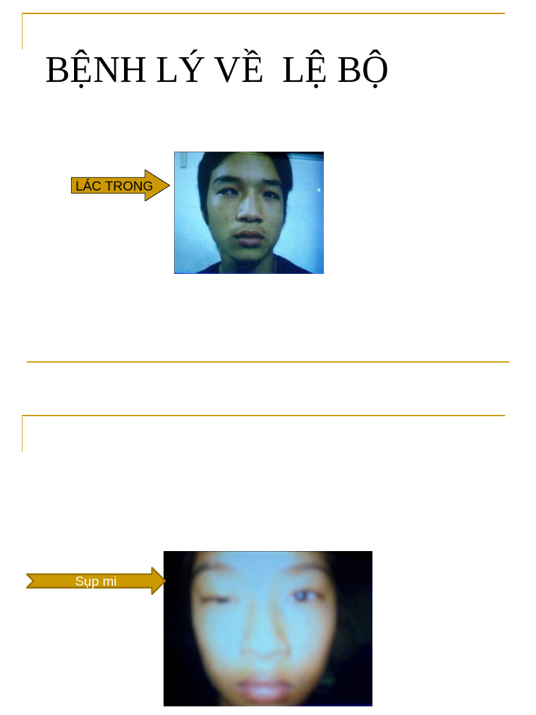 Hinh Anh Mat Thi | PDF