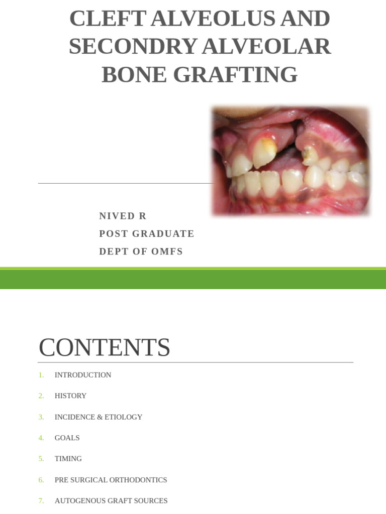 144, SABG Nived | PDF | Human Tooth | Orthodontics