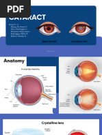 Cataract Coding Guidelines and ICD-10 | PDF | Cataract | Glaucoma