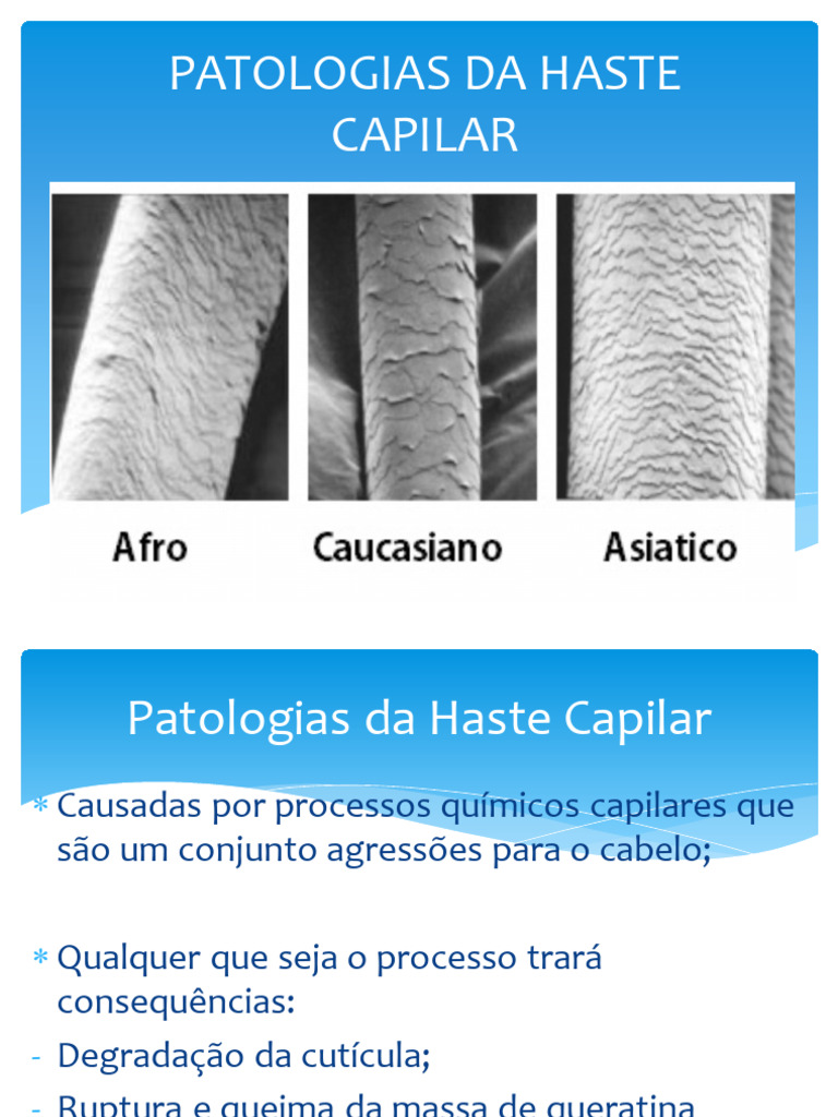 Patologias Da Haste Capilar | PDF | Cabelo
