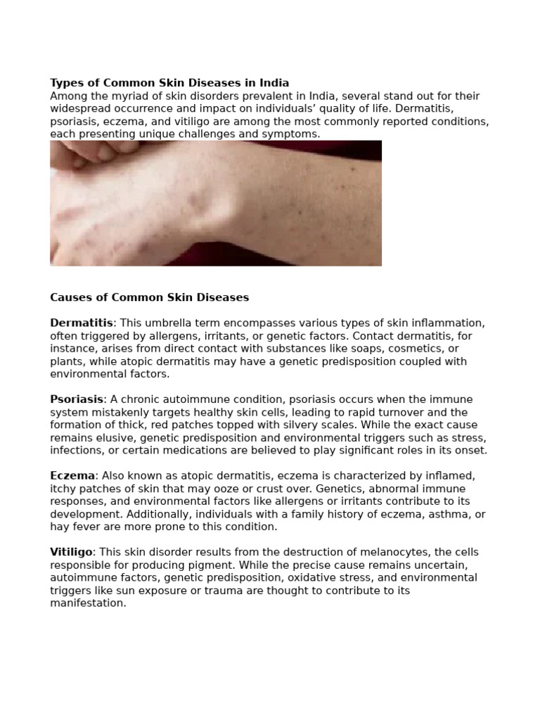 Most Common Dermatological Diseases in India | PDF | Dermatitis | Psoriasis