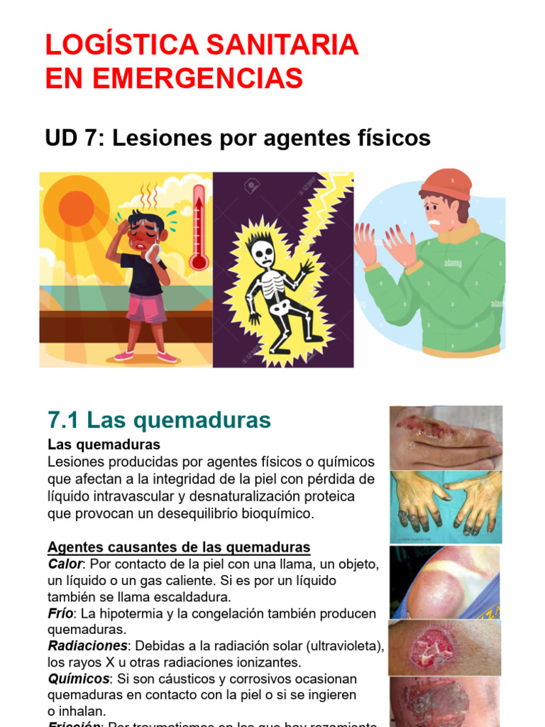 Presentación UD7.Lesiones Por Agentes Físicos | PDF | Quemar | Hipotermia