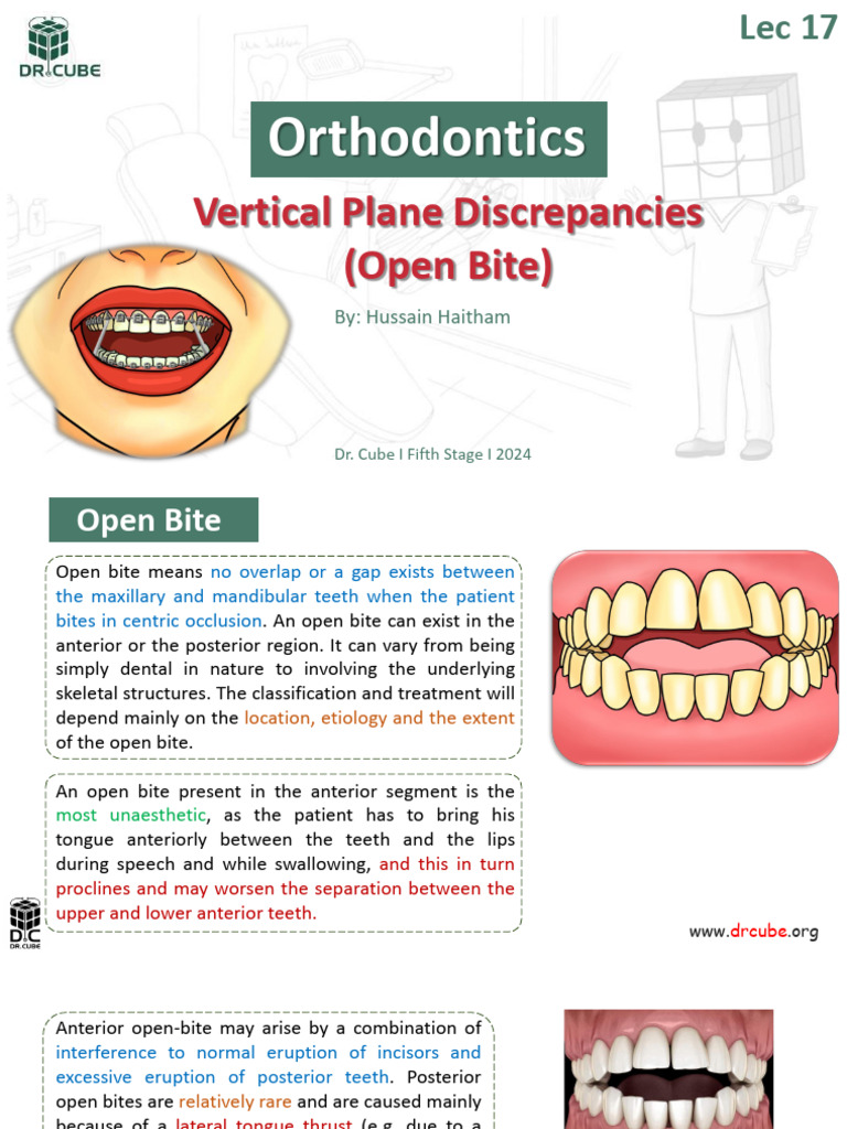 Ortho5 Lec.17 Open Bite | PDF | Dental Anatomy | Dentistry