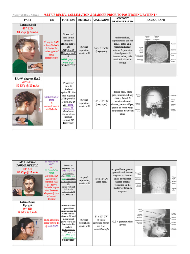 Skull Sinuses Nasal Bones Orbits | PDF | Skull | Human Nose