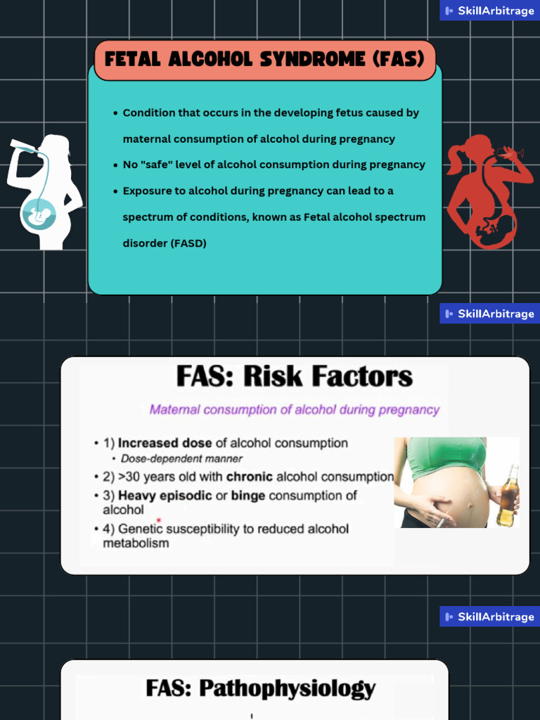 Fetal Alcohol Syndrome (FAS) | PDF