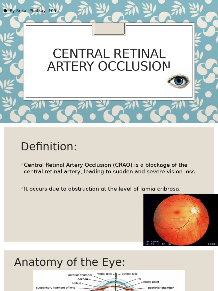 OPHTHAL.pptx 105 | PDF | Retina | Medical Specialties