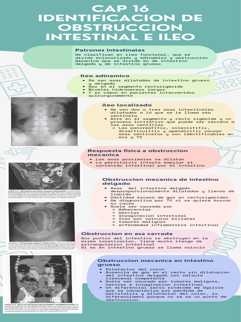 Cap 16 Identificacion de Obstruccion Intestinal e Ileo - 20240615 ...