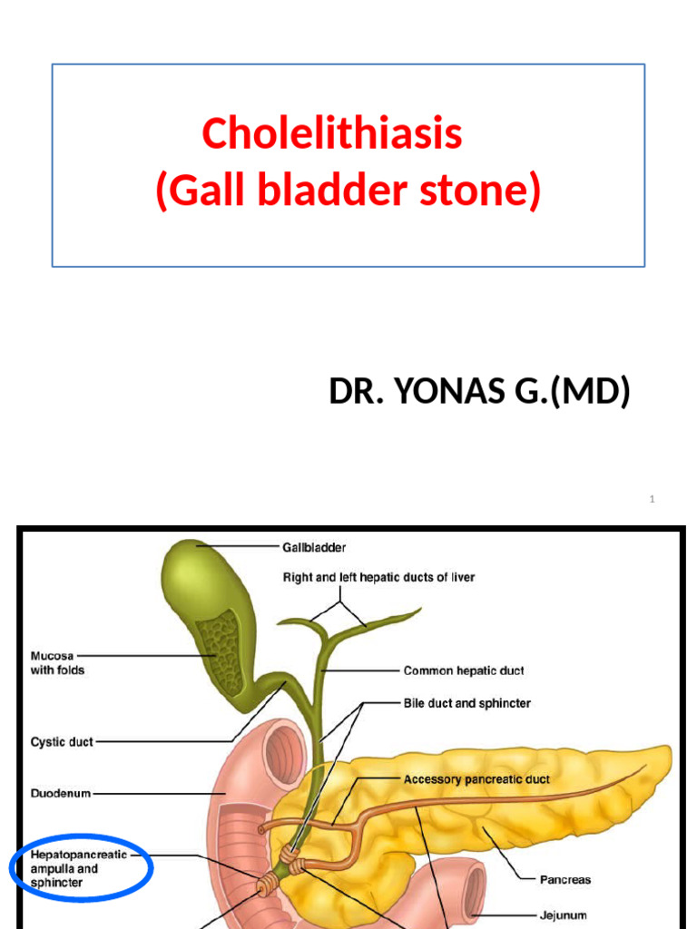 3. Cholelithiasis | PDF | Gallbladder | Bile