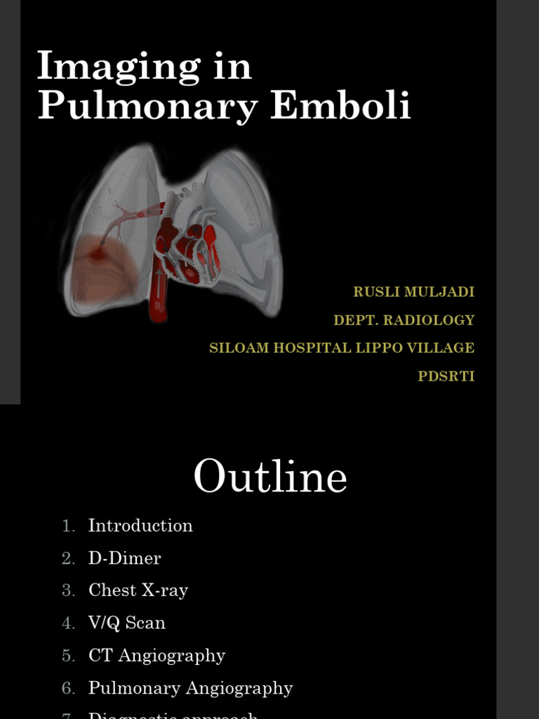 Imaging Techniques for Pulmonary Emboli | PDF | Embolism | Causes Of Death