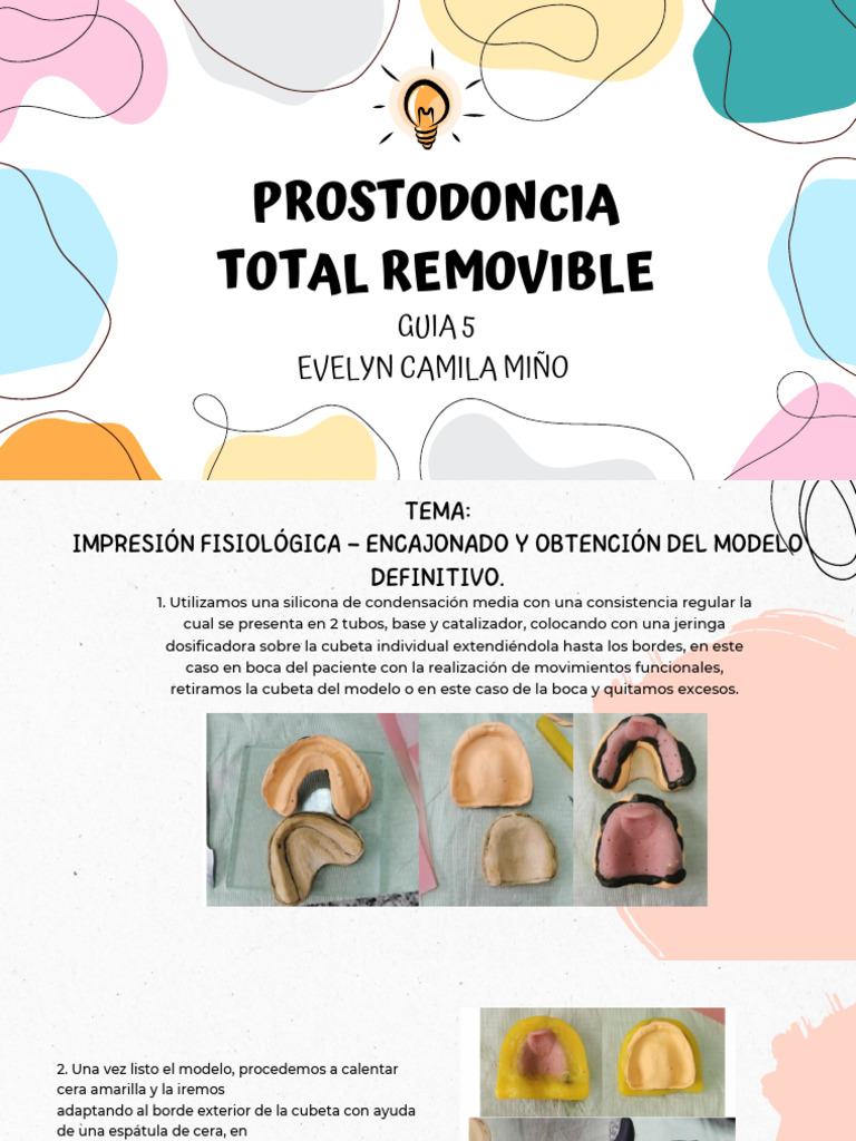 Impresión y Modelo en Prostodoncia Removible | PDF