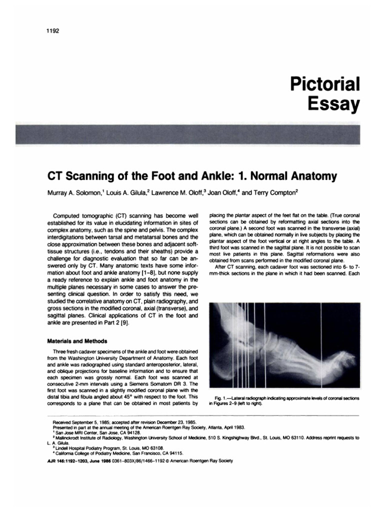 Solomon Et Al 2012 CT Scanning of The Foot and Ankle 1 Normal Anatomy ...