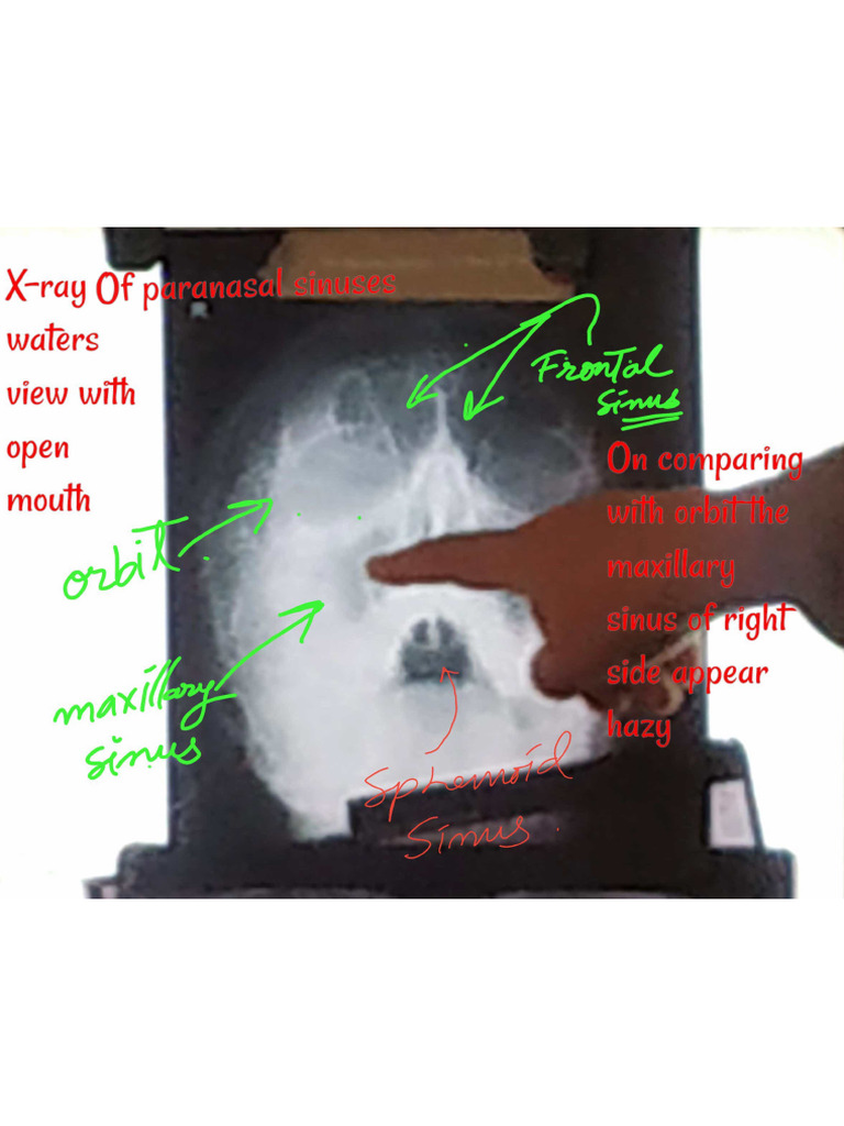 Ent X-Rays | PDF