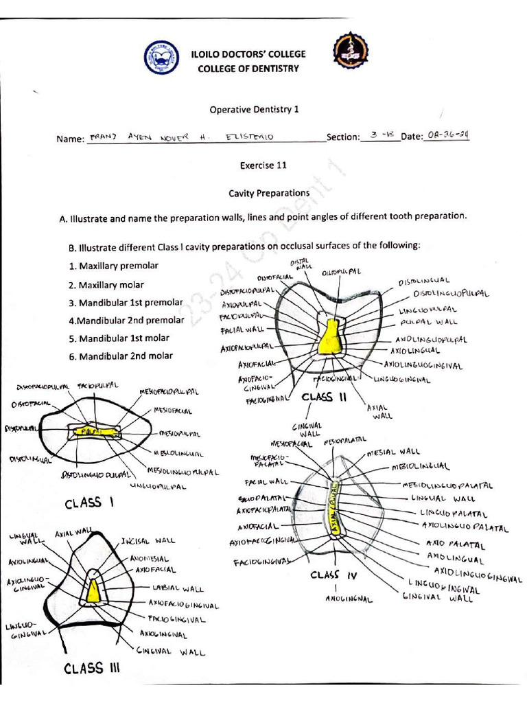 Elisterio Ex11 | PDF