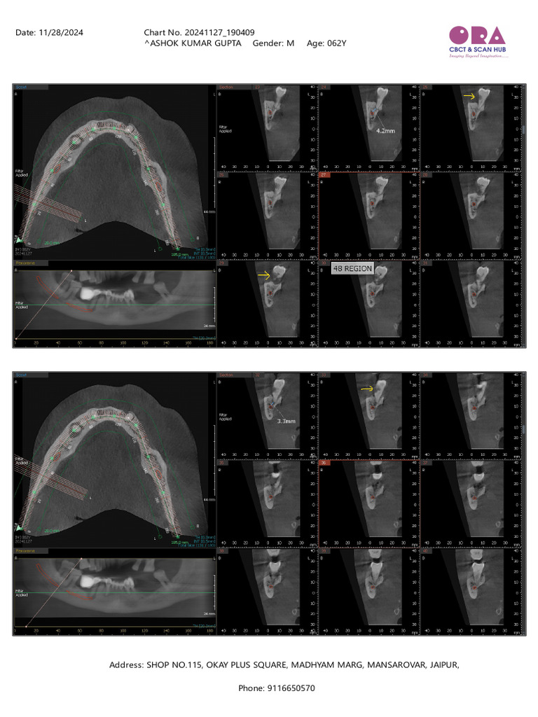 Ashok Kumar Gupta - Cross-Sections - Mandible | PDF