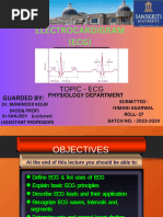 ECG Limb Lead Reversal - LITFL - ECG Library Diagnosis | PDF ...