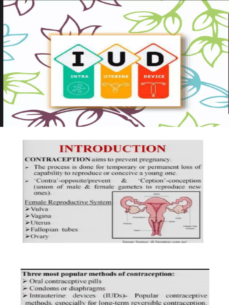 Intrauterine Devices... | PDF