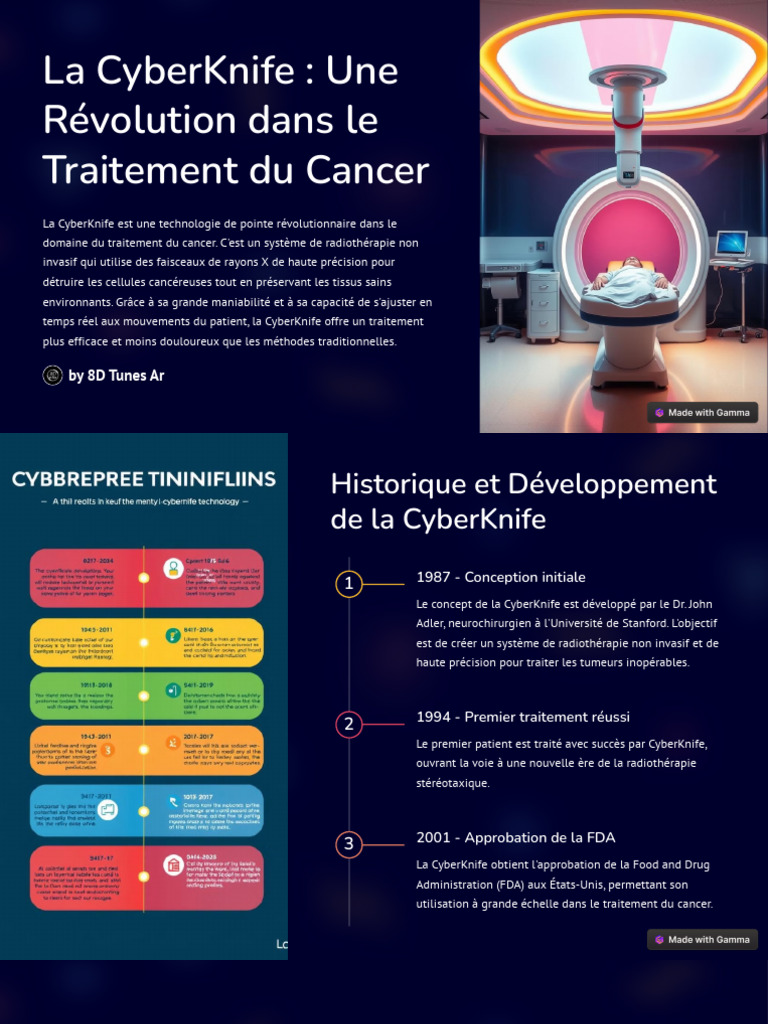 CyberKnife : Révolution dans le Cancer | PDF | Cancer | Métastase