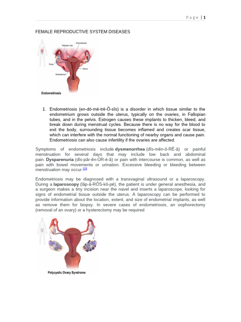 Science Reproductive of Female | PDF | Polycystic Ovary Syndrome ...