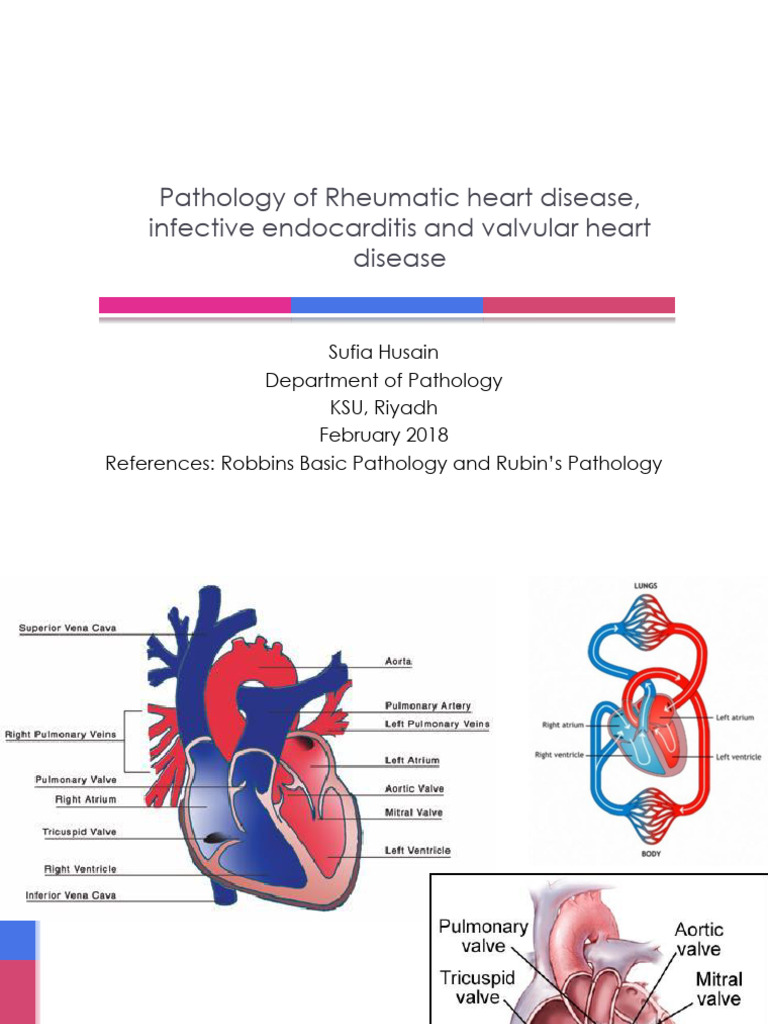 1- RHD, IE and VHD 2018 | PDF | Heart Valve | Heart