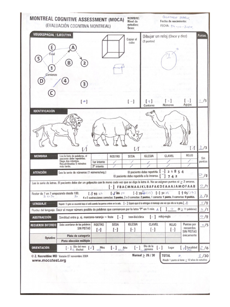 Montreal Cognitive Assessment (Moca) | PDF