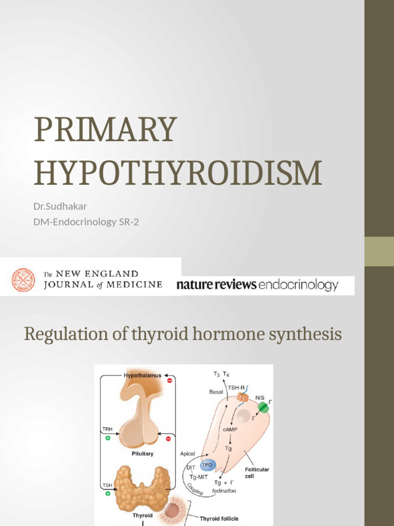 Understanding Primary Hypothyroidism | PDF
