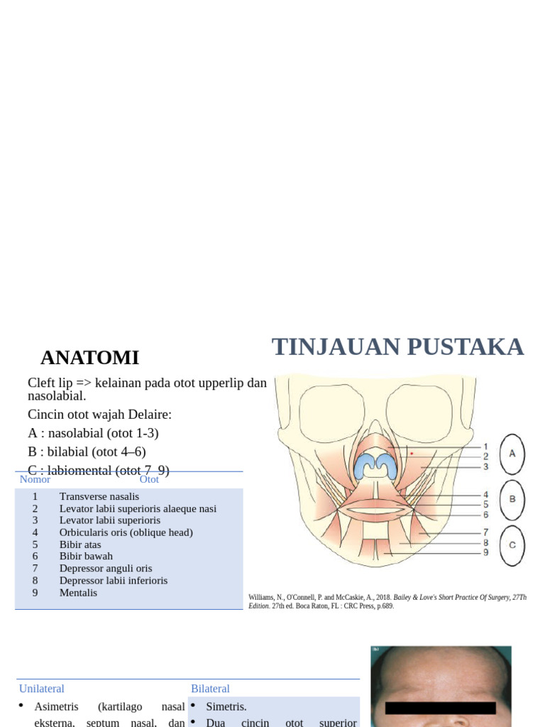 Anatomi, Embriologi Bibir Sumbing | PDF
