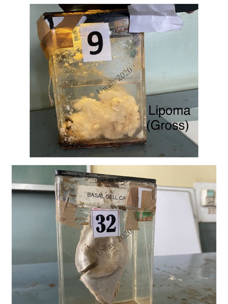 Pathology Gross Specimens!!!!! | PDF