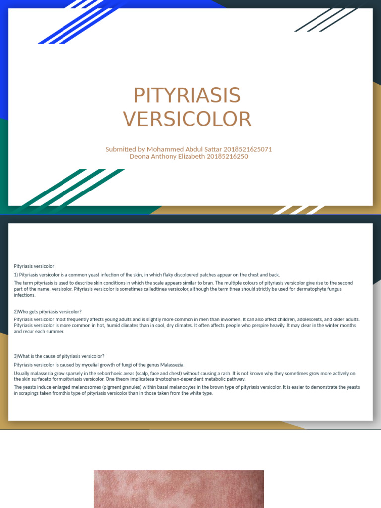 Understanding Pityriasis Versicolor | PDF | Cutaneous Conditions | Mycology