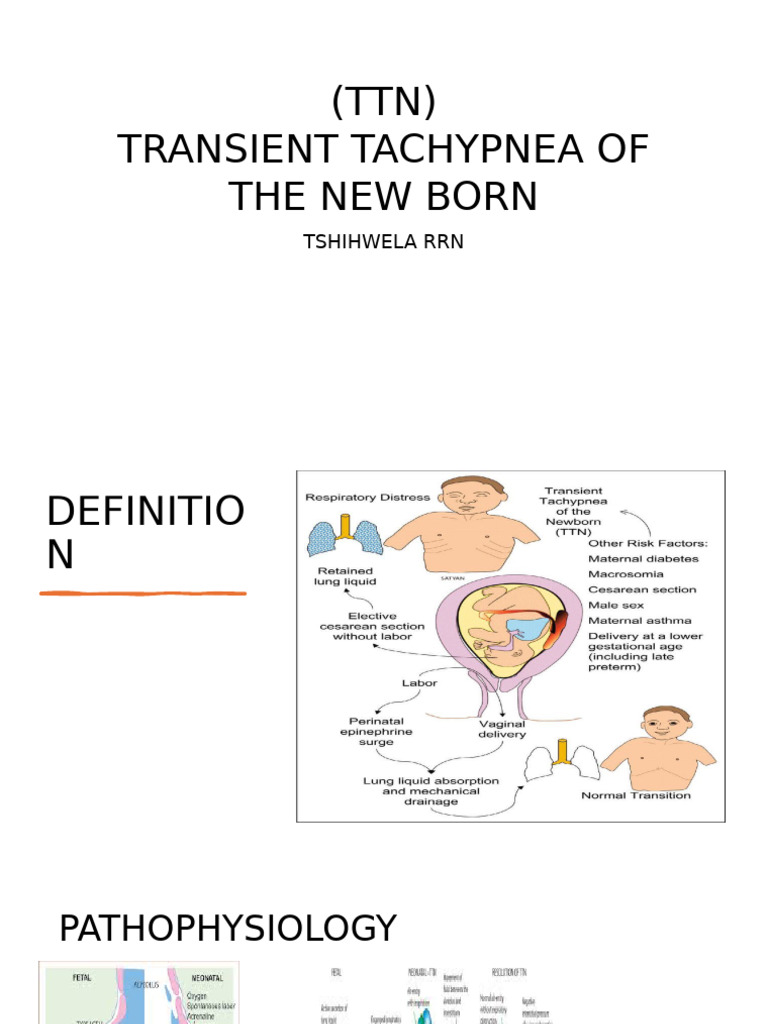 Understanding Transient Tachypnea in Newborns | PDF